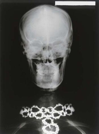 X-ray of womans skull with Van Cleef and Arpels necklace, Paris by ...