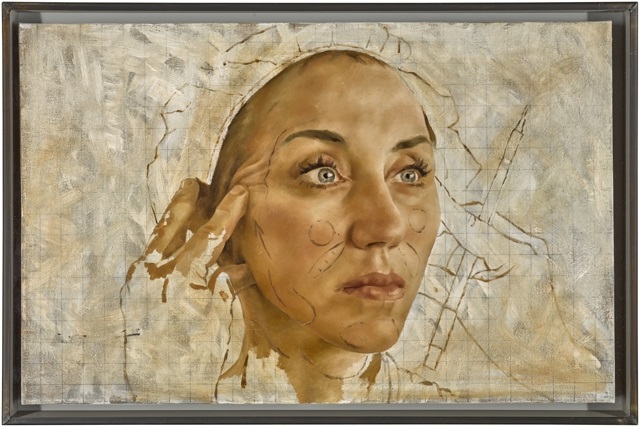 Rhytidectomy III With Surgeons Hands by Jonathan Yeo on artnet